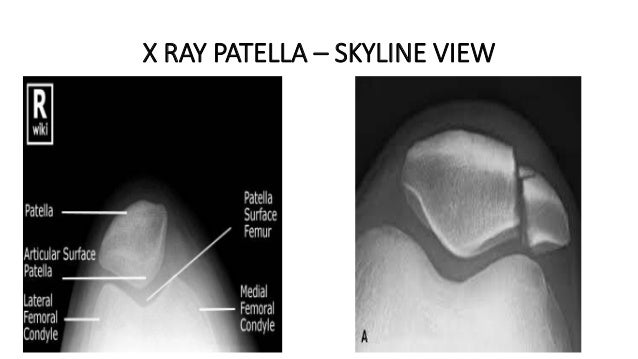 Lower limb radiology