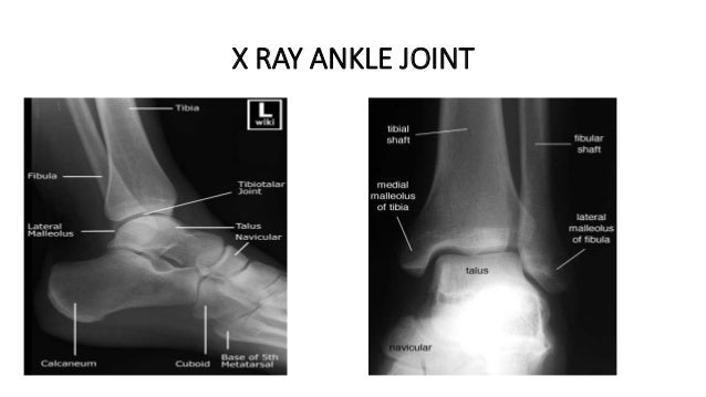 Lower limb radiology