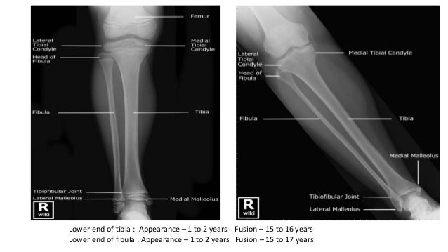 Lower limb radiology