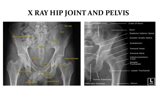Lower limb radiology
