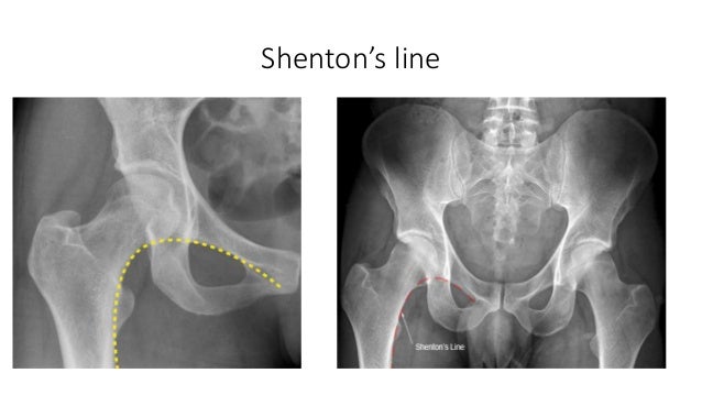 Lower limb radiology