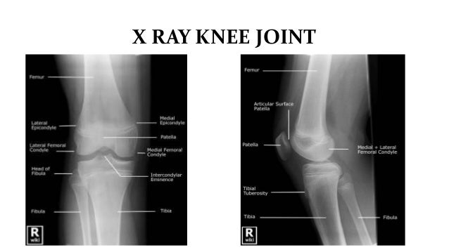 Lower limb radiology