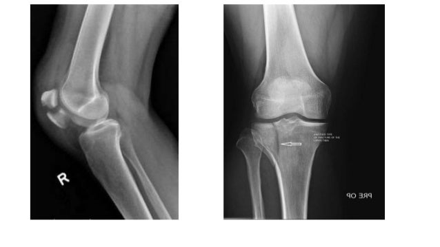 Lower limb radiology