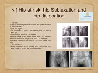 Lower limb reconstruction in tetraplegia | PPTX