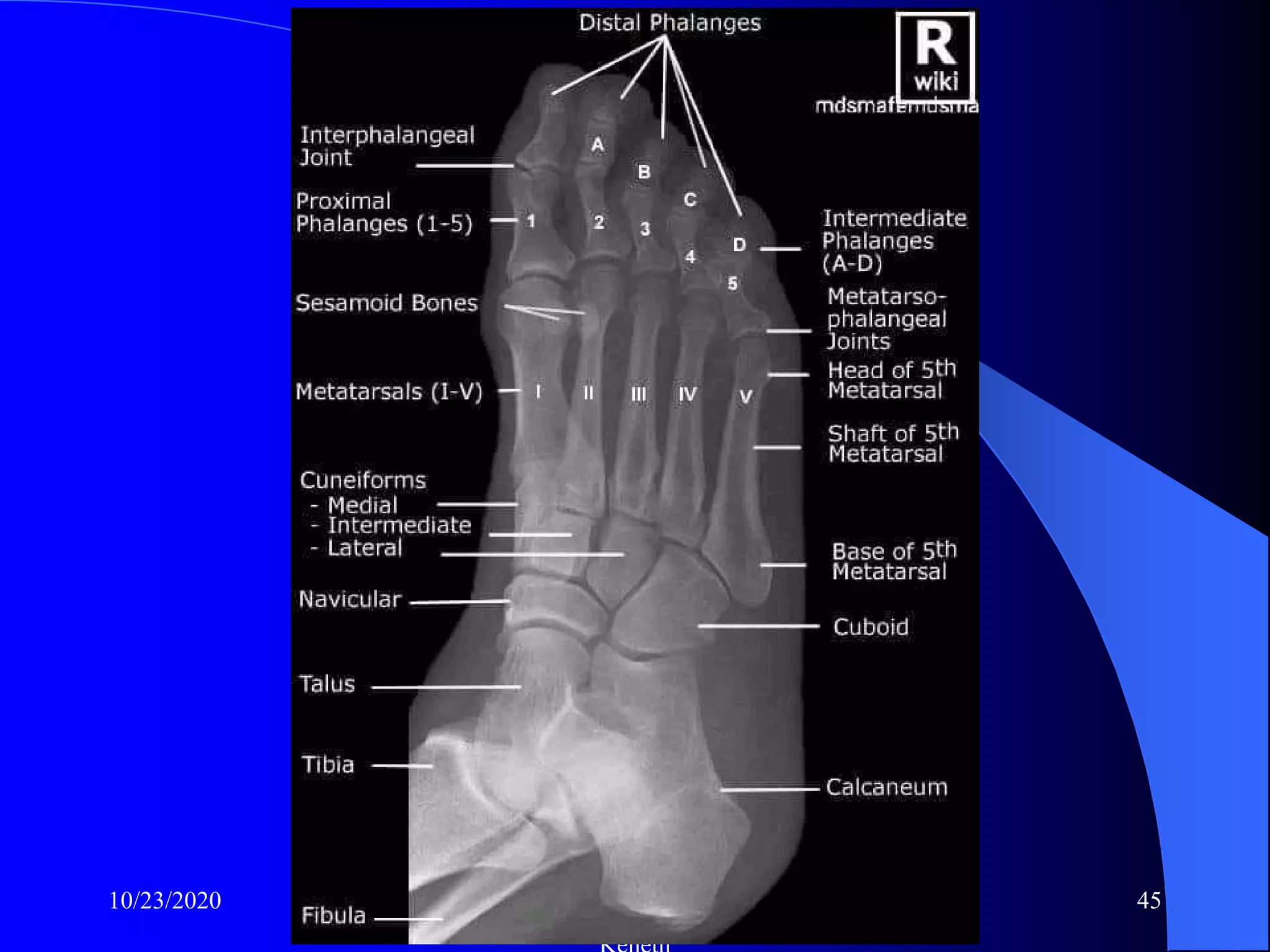 Lower limbs x ray radiology training resource nchanji nkeh keneth | PPT