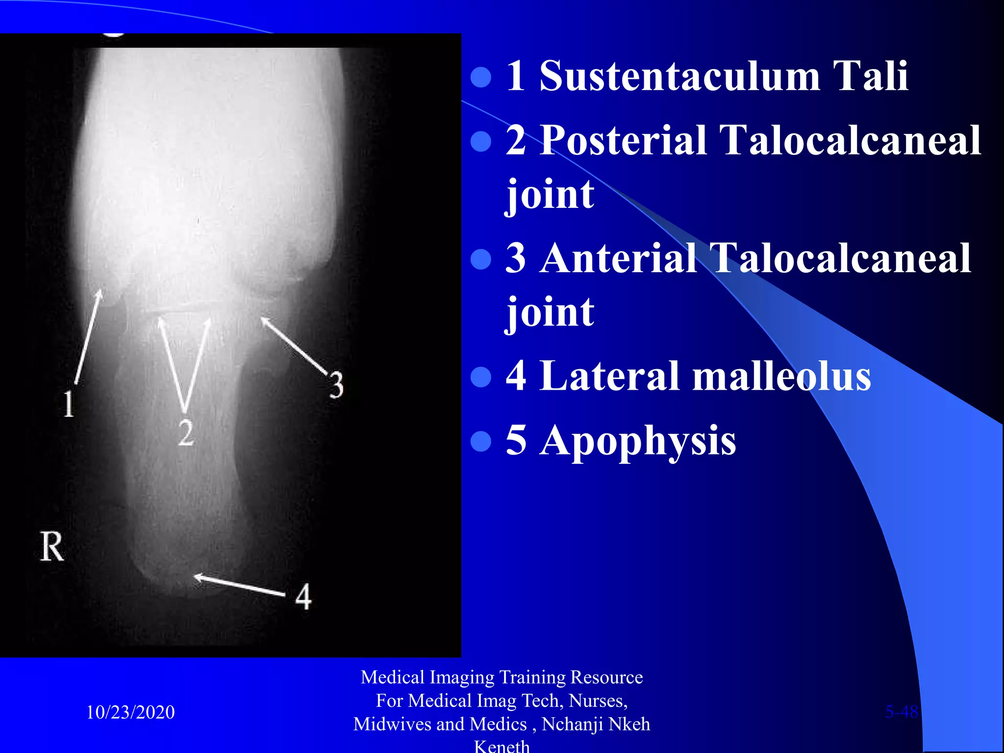 Lower limbs x ray radiology training resource nchanji nkeh keneth | PPT