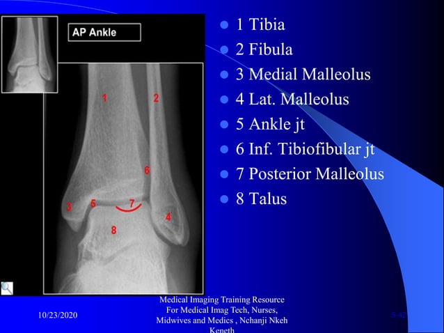 Lower limbs x ray radiology training resource nchanji nkeh keneth | PPT