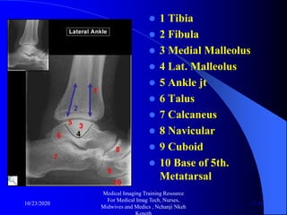 Lower limbs x ray radiology training resource nchanji nkeh keneth | PDF