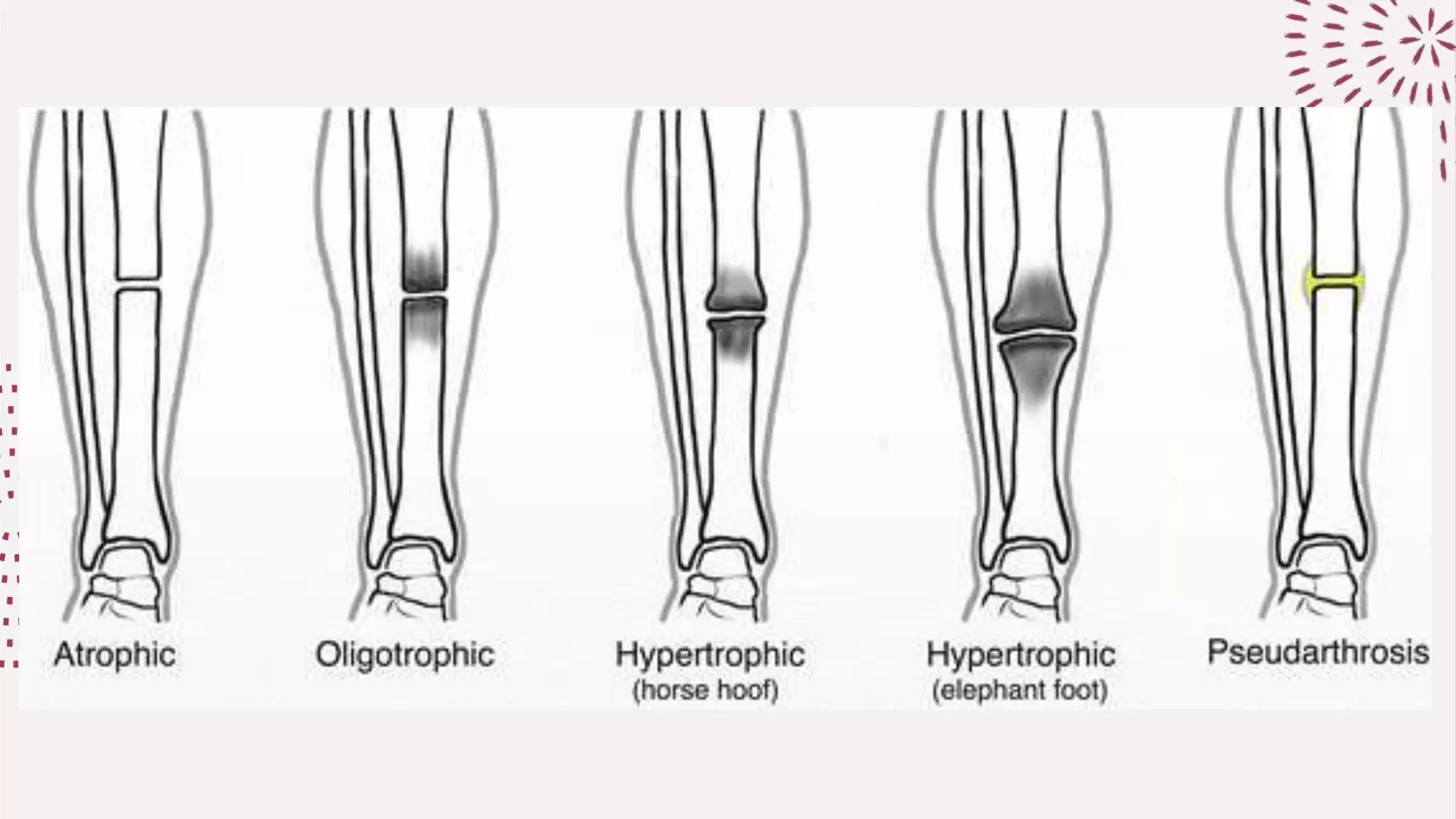 Lower limb trauma case.pptx