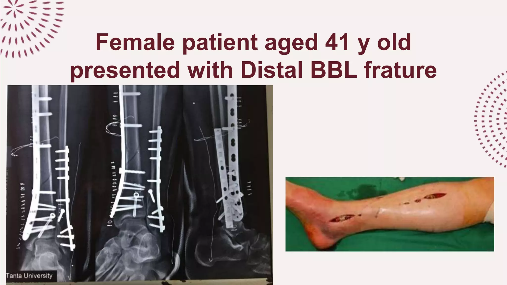 Lower limb trauma case.pptx