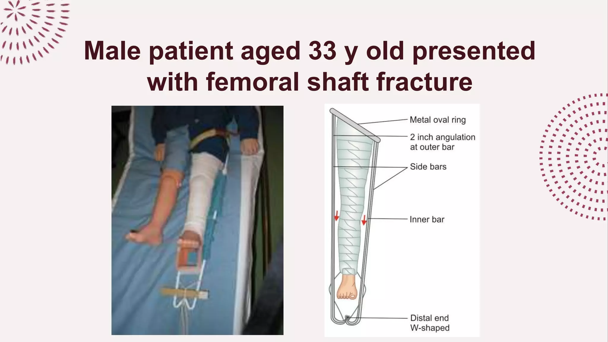 Lower limb trauma case.pptx