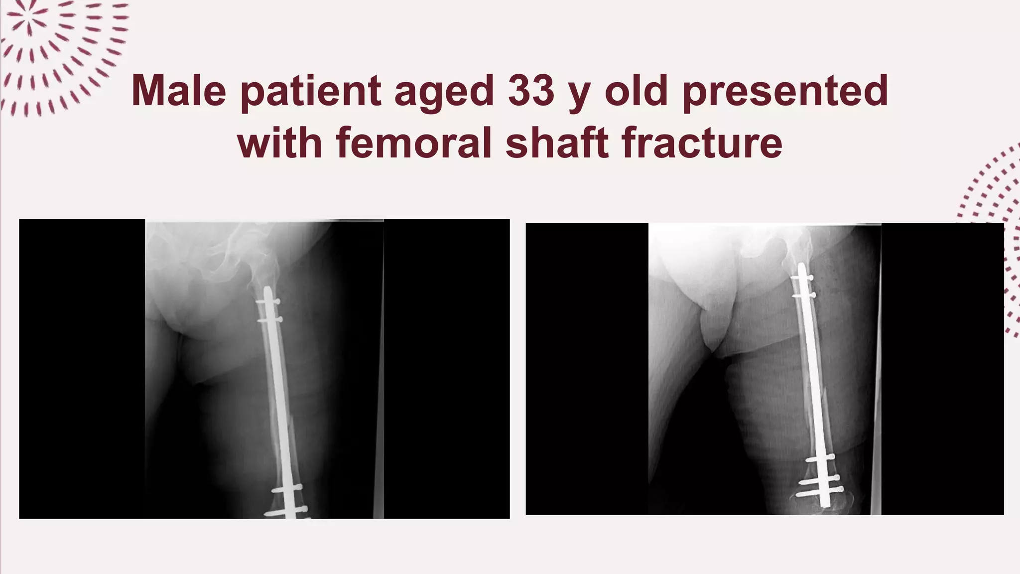 Lower limb trauma case.pptx
