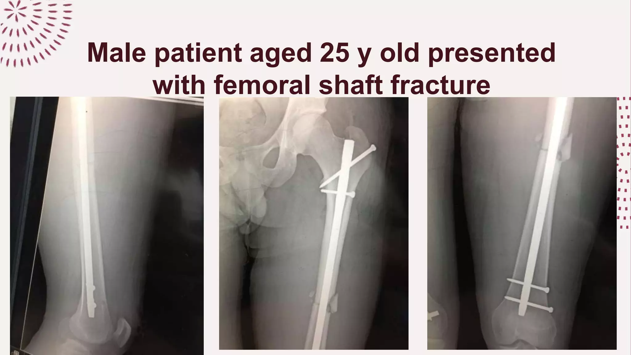 Lower limb trauma case.pptx