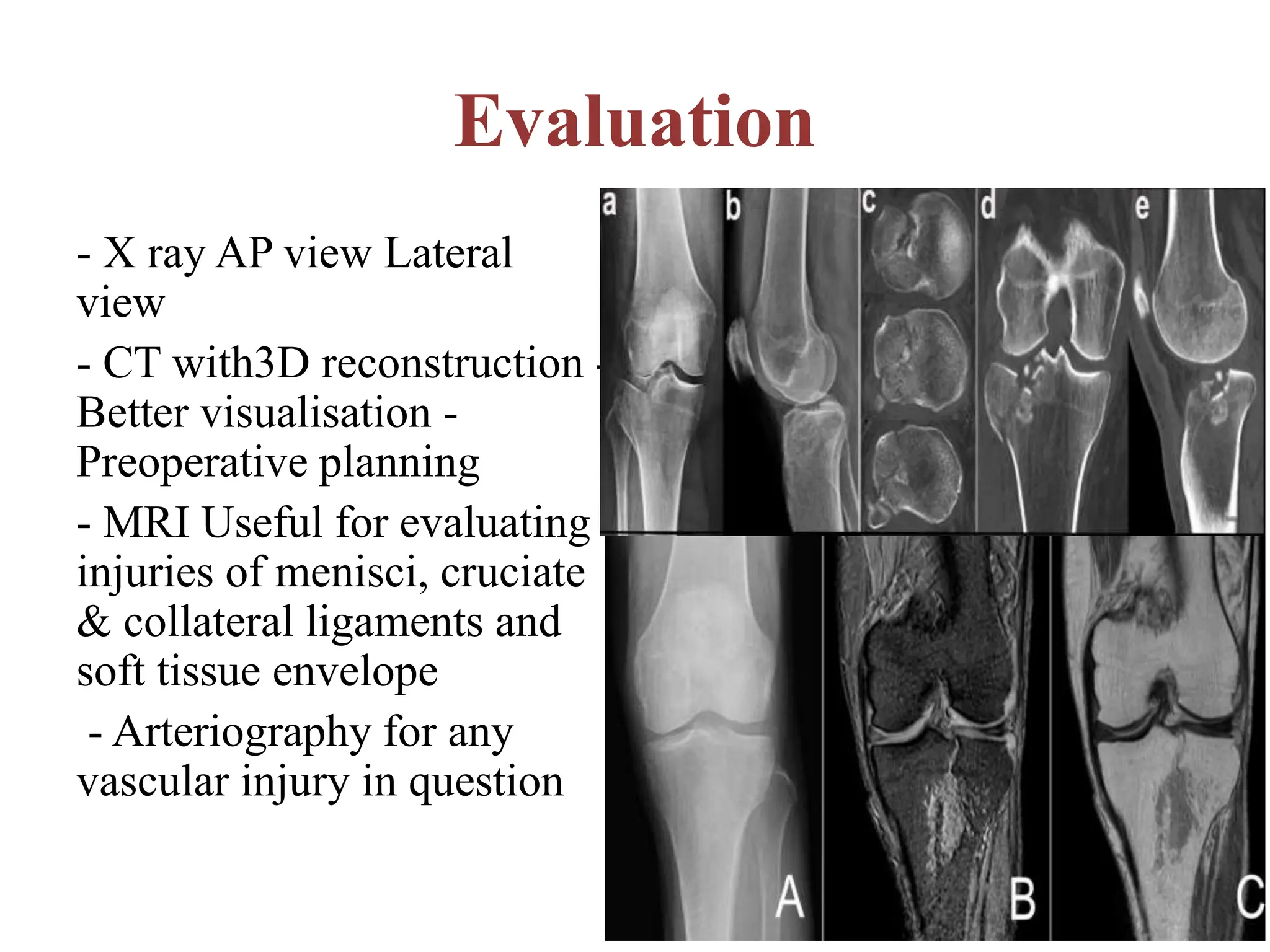 lower limb trauma conhhhhhhhhhht....pptx