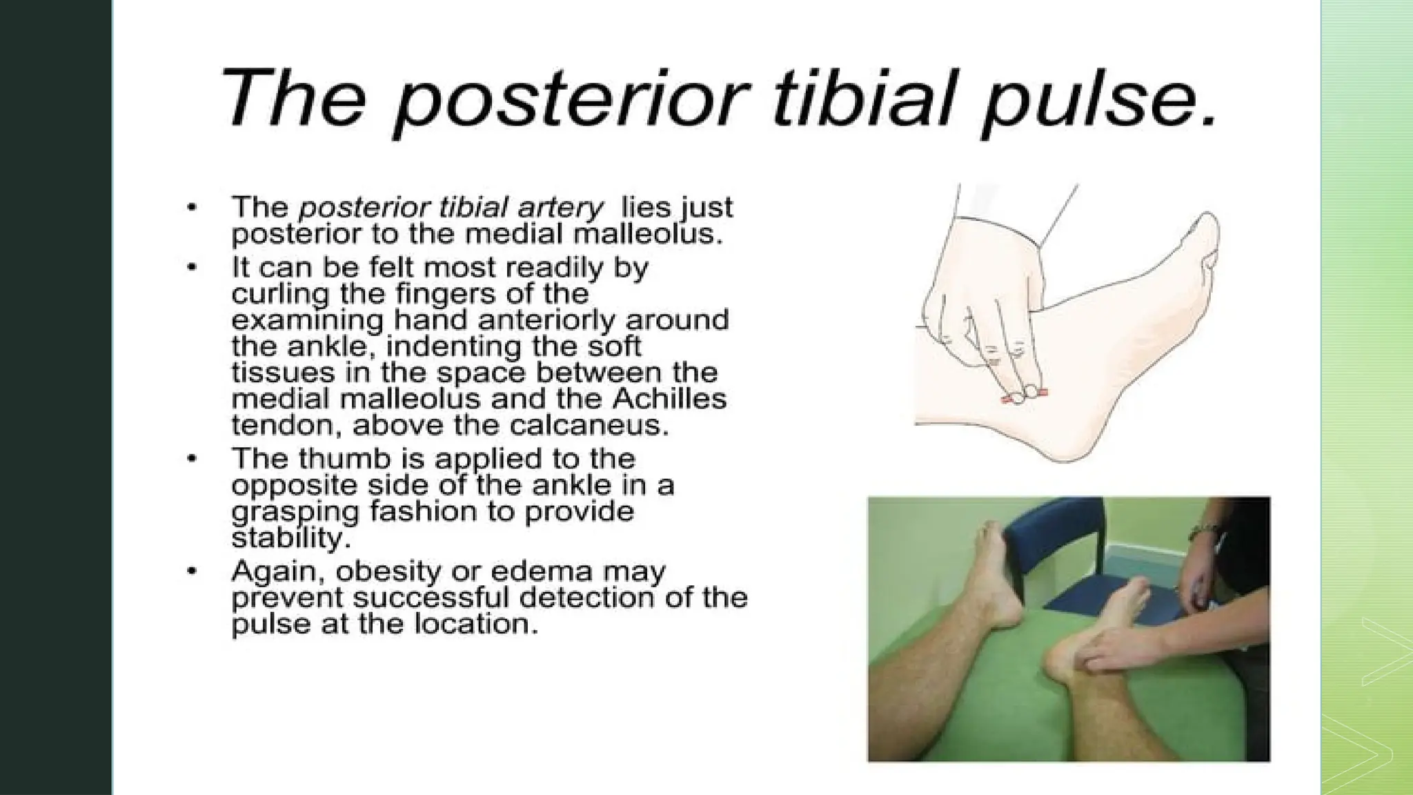 Lower Limb Arterial Vascular Examination.pptx
