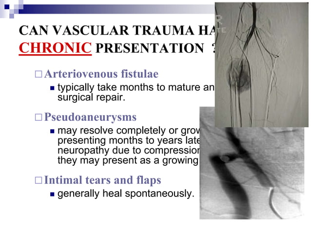 Lower Limb Vascular Trauma | PPTX