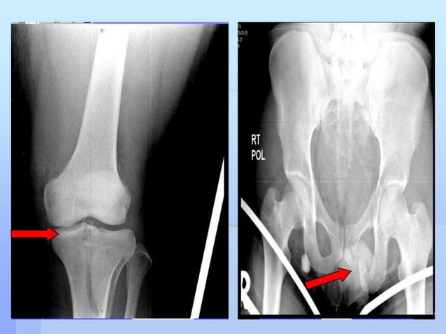 Lower Limb Vascular Trauma | PPTX
