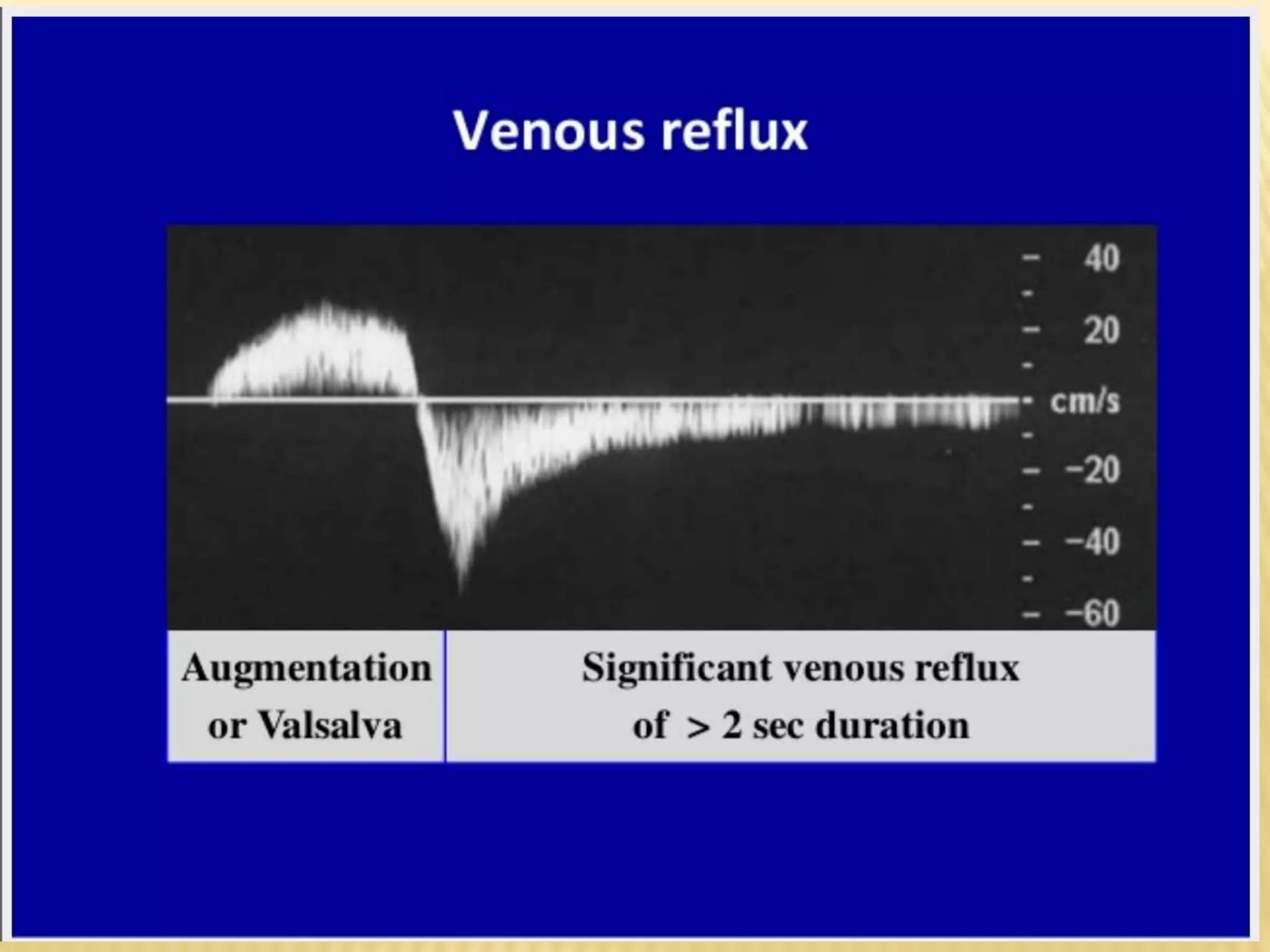 Venous Doppler Lower limb Dr Mukesh Tilgam | PPTX