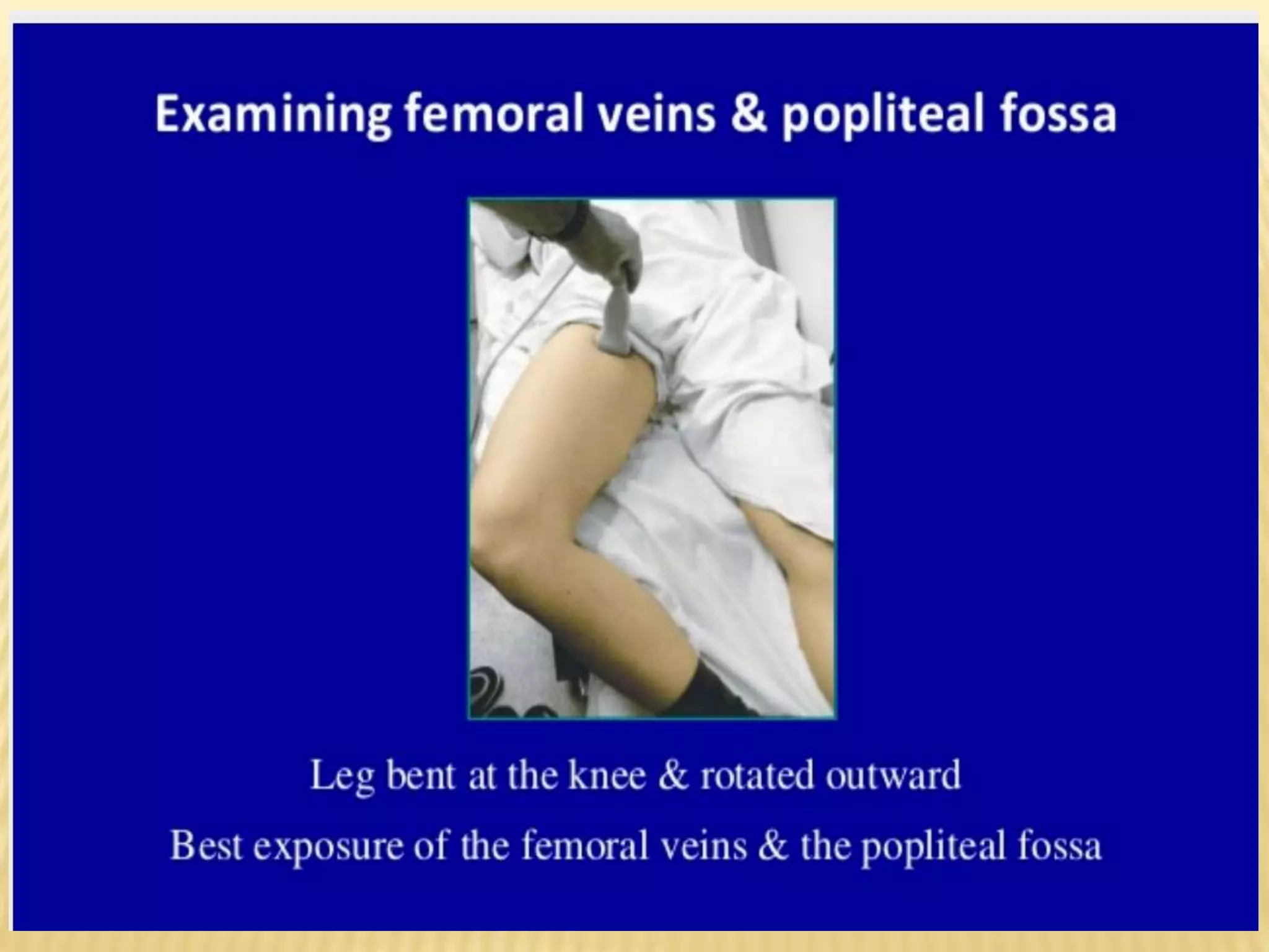 Venous Doppler Lower limb Dr Mukesh Tilgam | PPTX