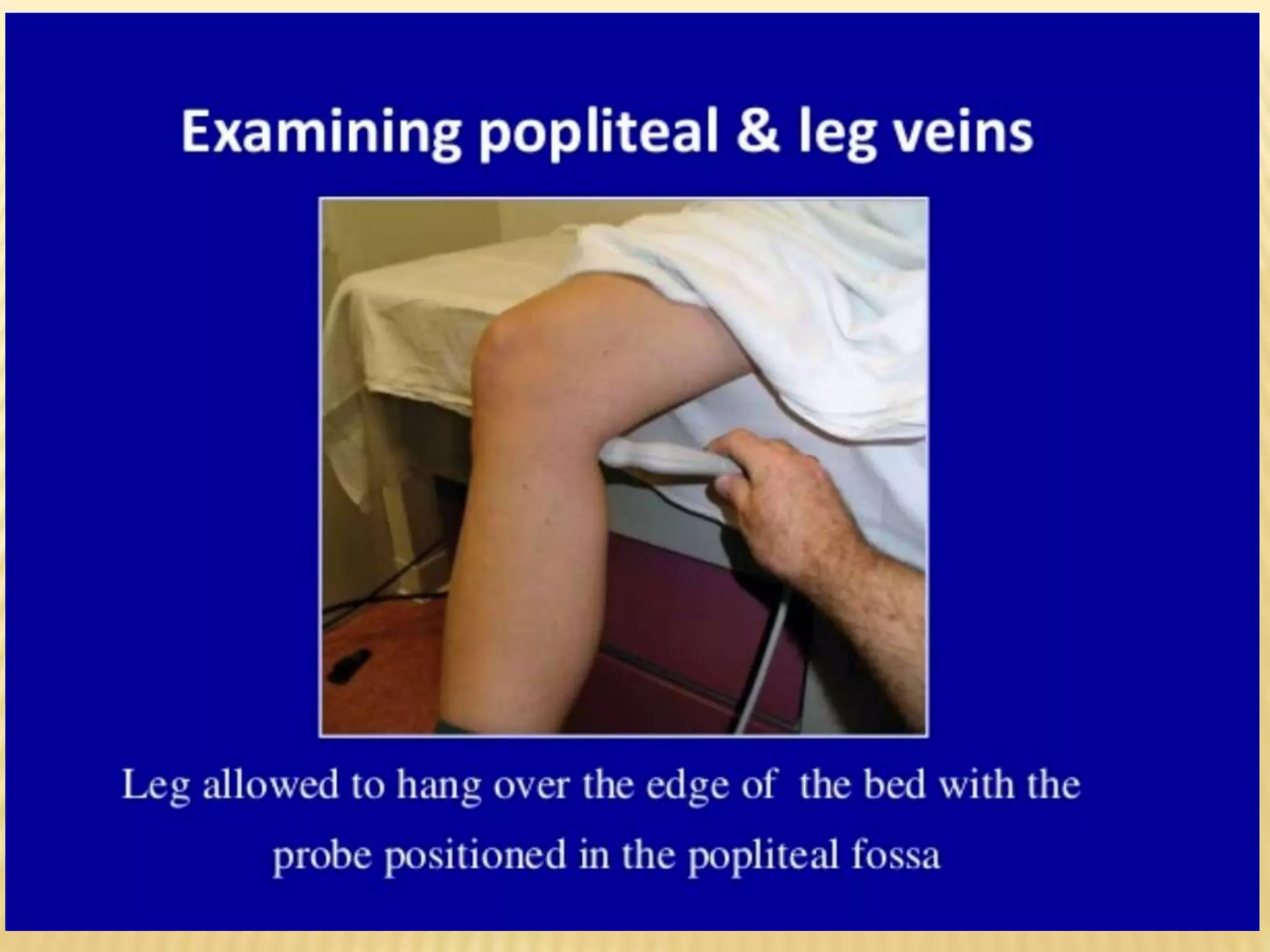Venous Doppler Lower limb Dr Mukesh Tilgam | PPTX