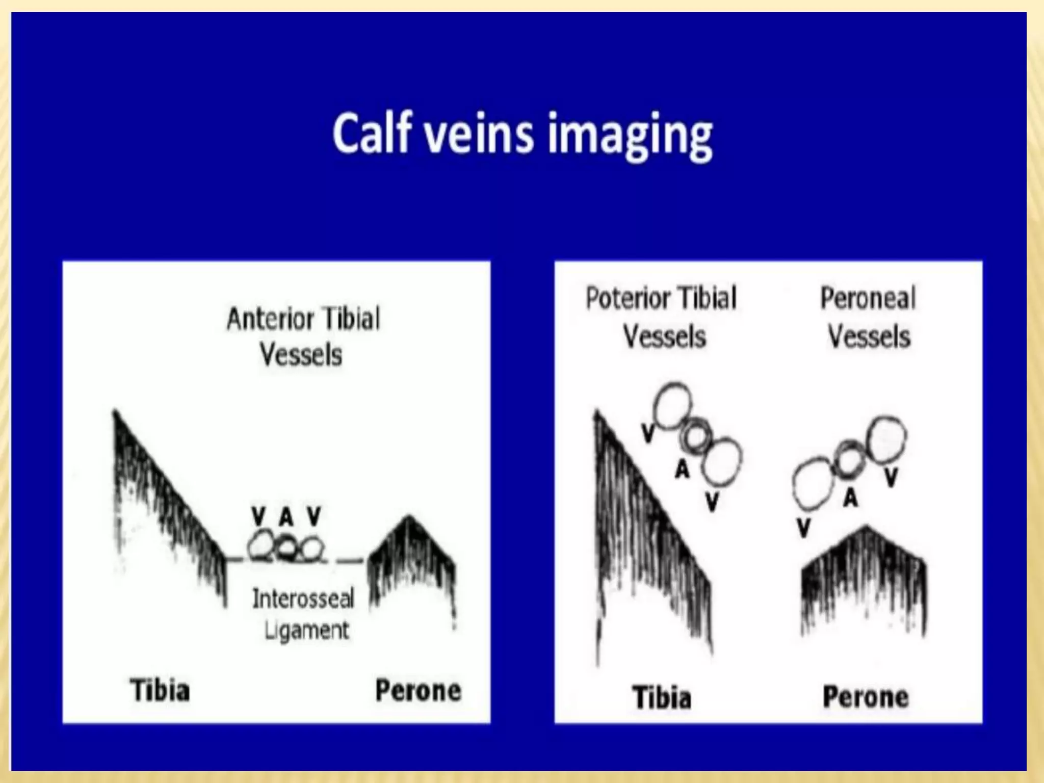 Venous Doppler Lower limb Dr Mukesh Tilgam | PPTX