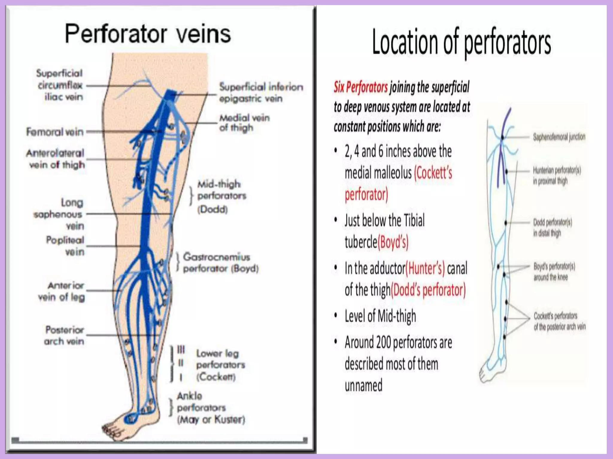 Venous Doppler Lower limb Dr Mukesh Tilgam | PPTX