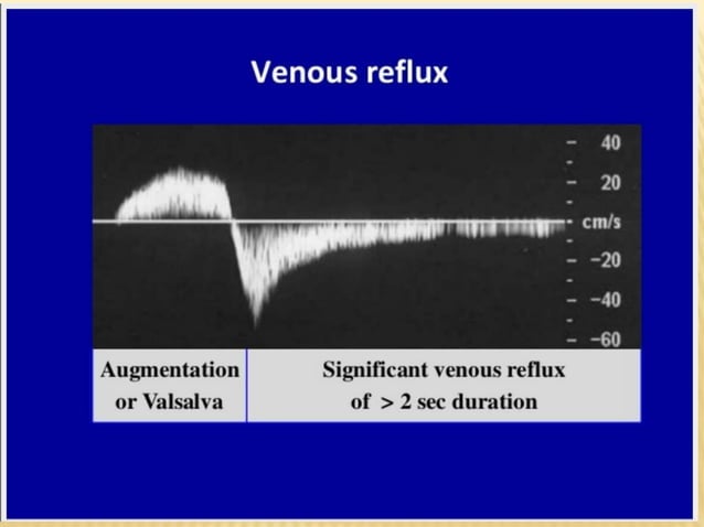Venous Doppler Lower limb Dr Mukesh Tilgam | PPTX
