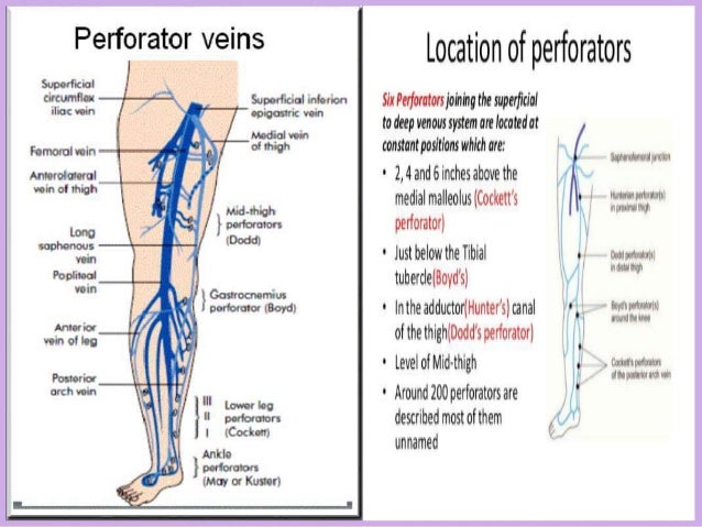Venous Doppler Lower limb Dr Mukesh Tilgam