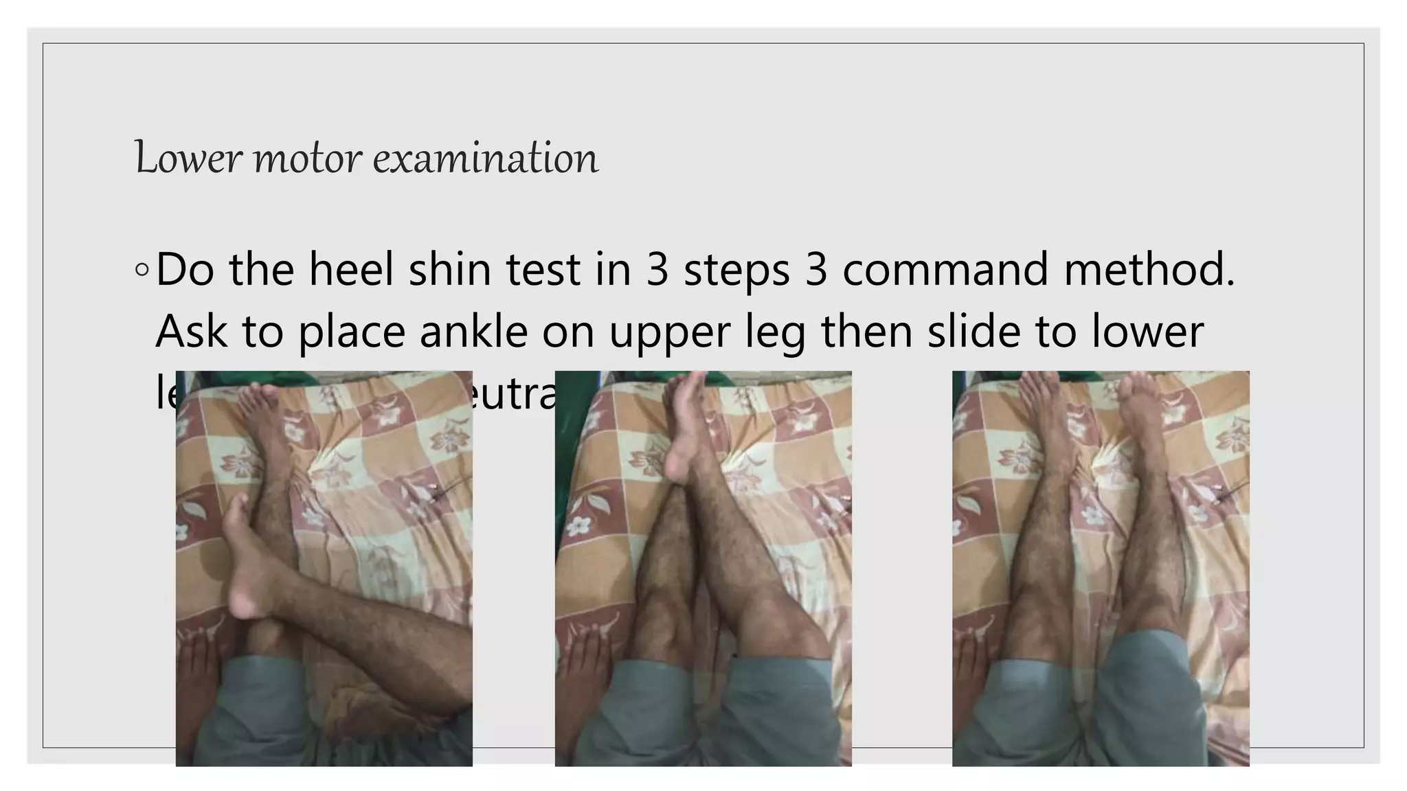 Lower motor neuron examination osce | PPTX