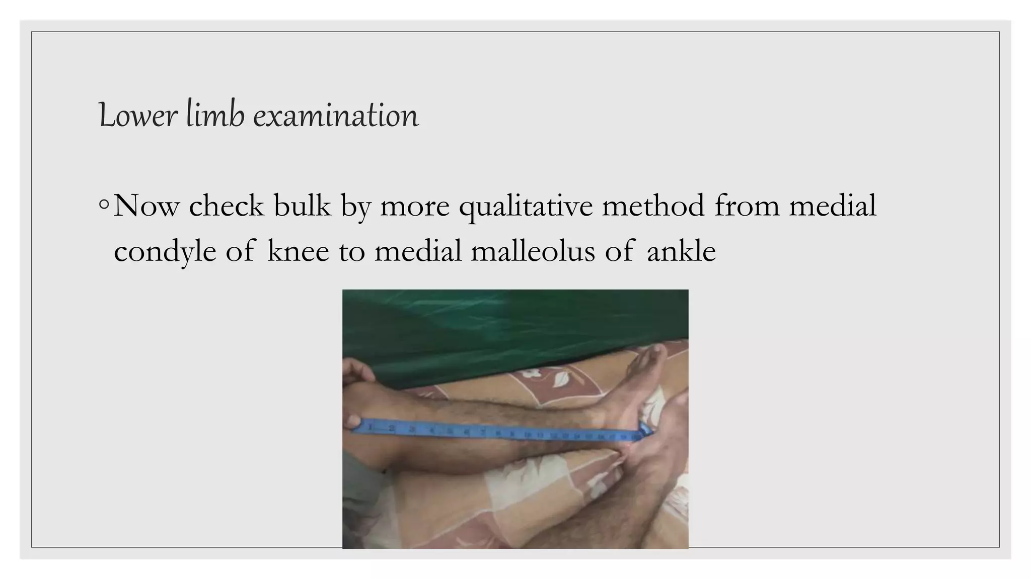 Lower motor neuron examination osce | PPTX