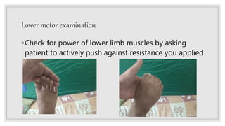 Lower motor neuron examination osce | PPTX
