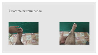 Lower motor neuron examination osce | PPTX