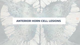 Spinal cord disease and Lower motor neurone disorders in Paediatrics | PDF