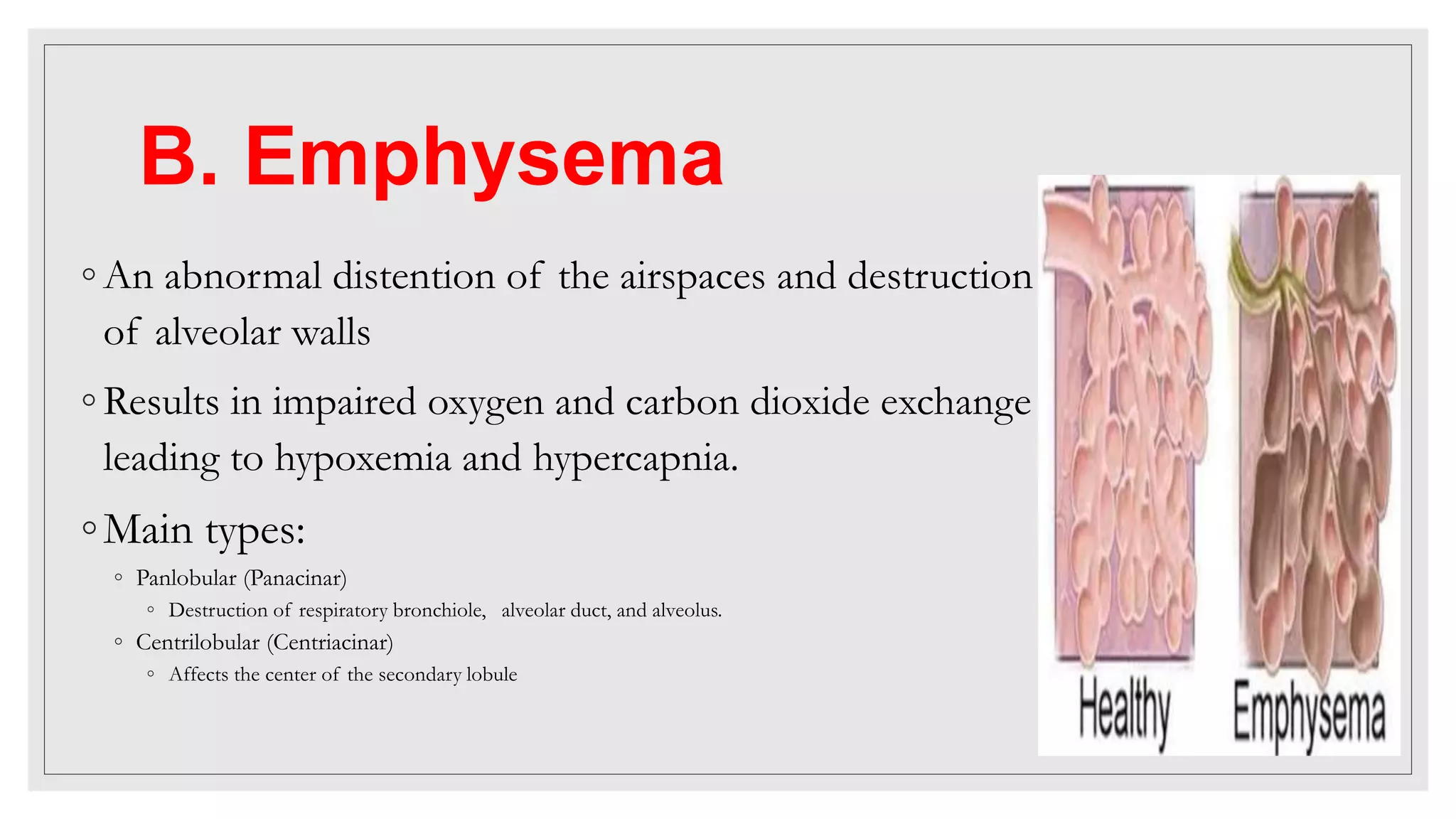 Lower respiratory disorders | PPTX