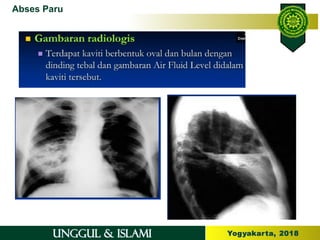 Lower Respiratory Infection- Gina new.ppt