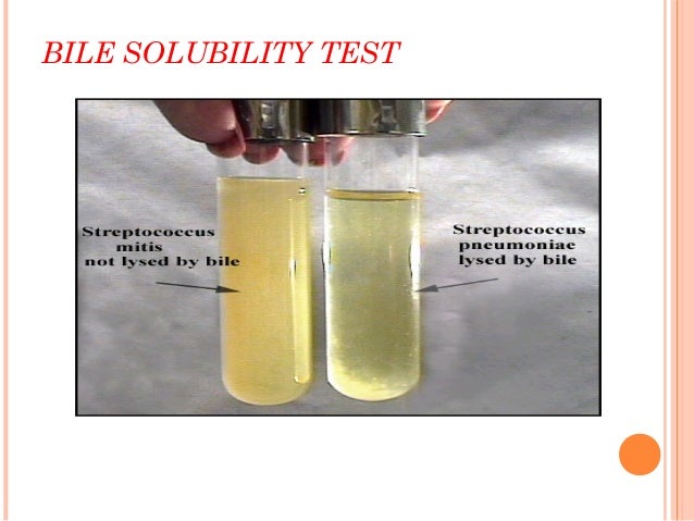 Laboratory diagnosis of Lower respiratory tract infection including t…