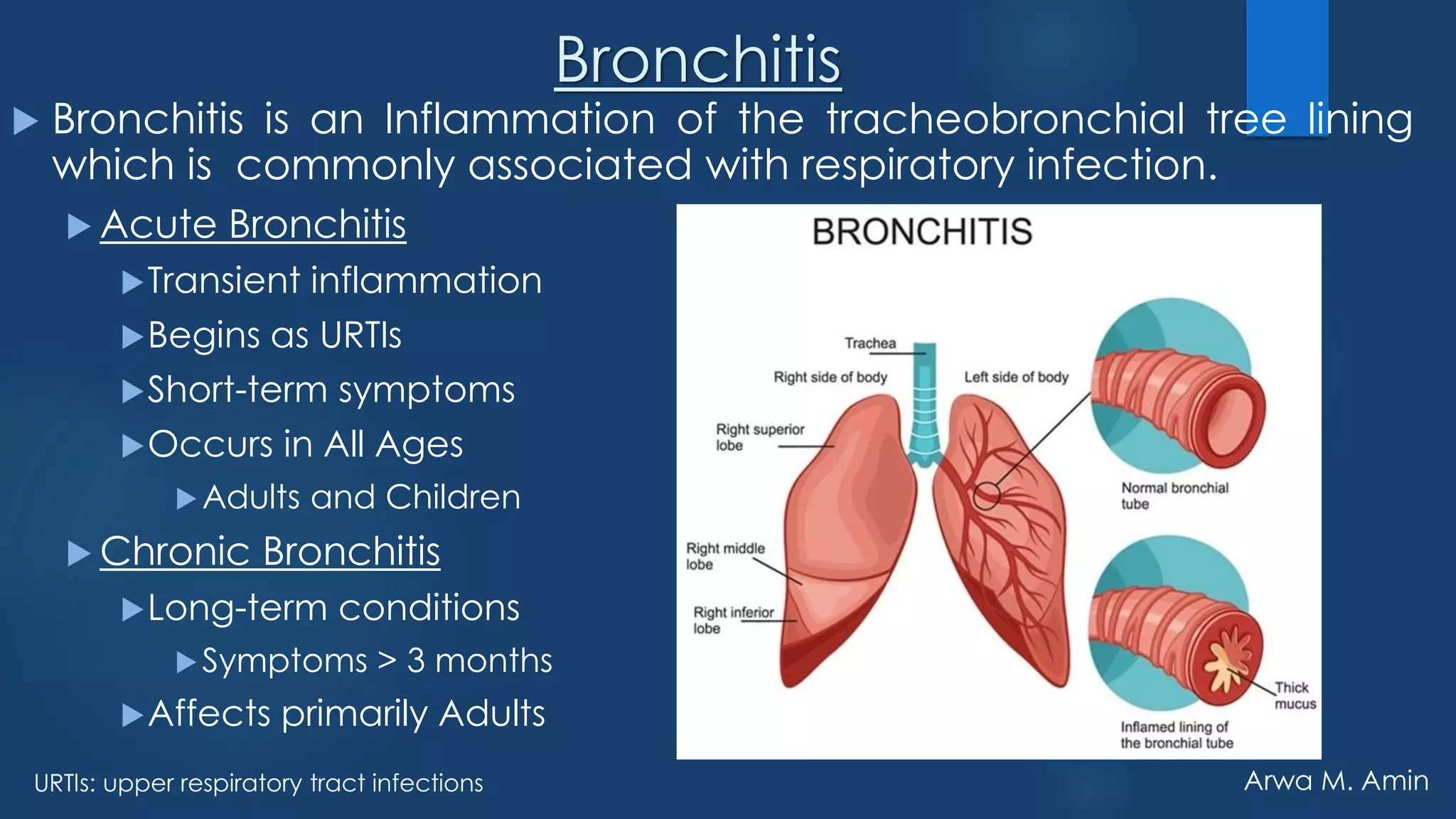 Bronchitis: An overview | PPT