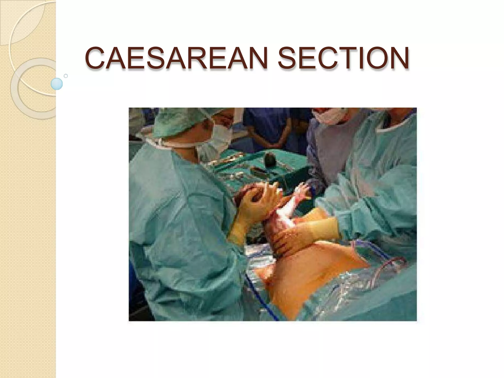 LOWER SEGMENT CAESAREAN SECTION.pptx