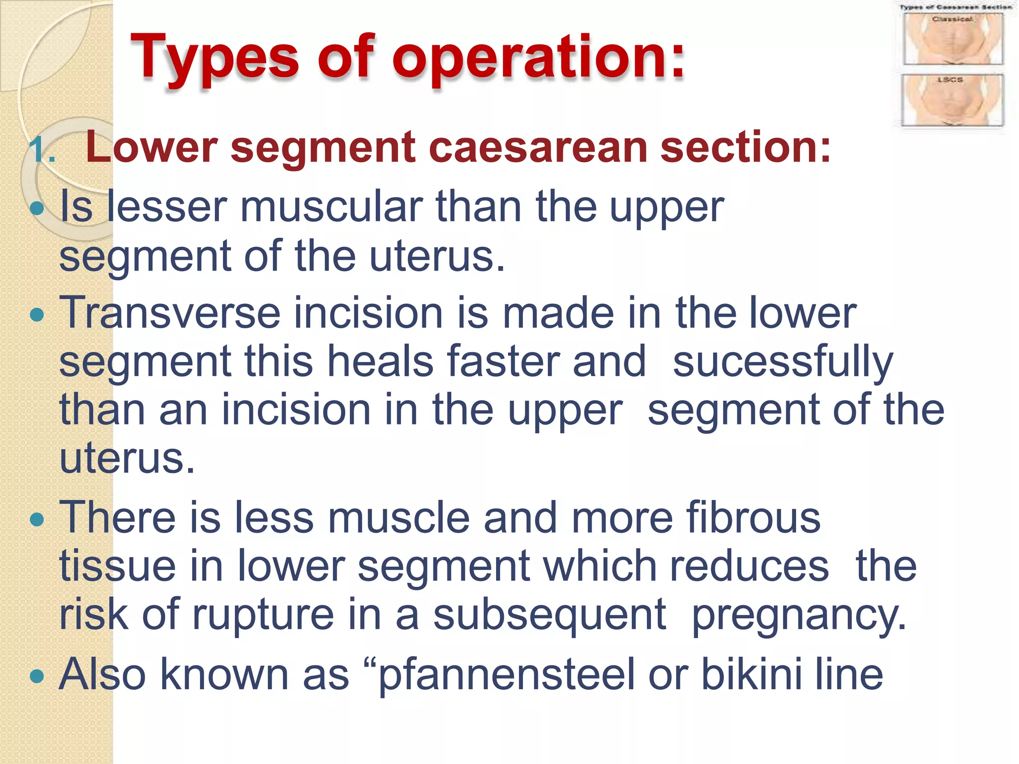 LOWER SEGMENT CAESAREAN SECTION.pptx