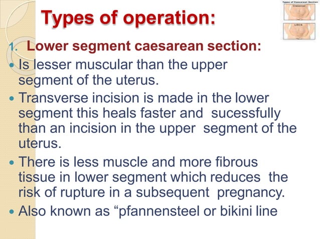 LOWER SEGMENT CAESAREAN SECTION.pptx