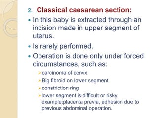 LOWER SEGMENT CAESAREAN SECTION.pptx