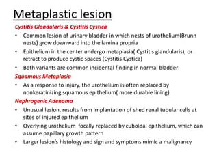 Lower Urinary Tract pathology.ppt