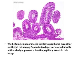 Lower Urinary Tract pathology.ppt
