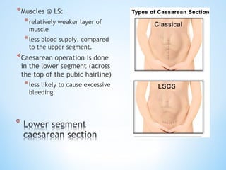 Lower uterine segment | PPT