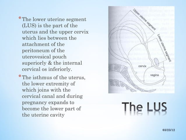 Lower uterine segment | PPT