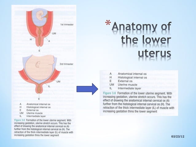 Lower uterine segment | PPT