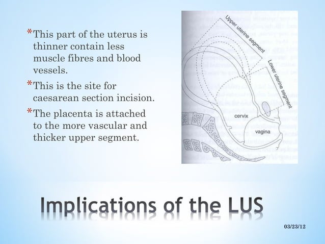 Lower uterine segment | PPT