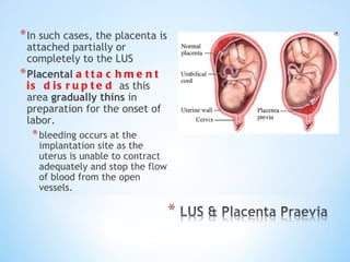 Lower uterine segment | PPT