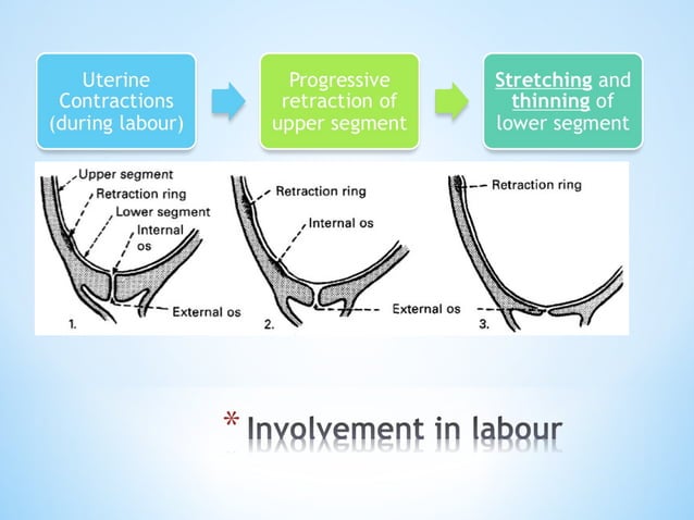 Lower uterine segment