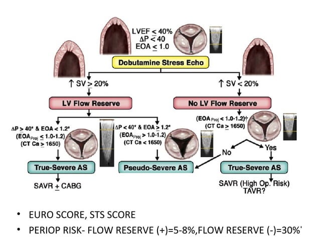 Low flow Aortic Stenosis-latest explanations | PPT